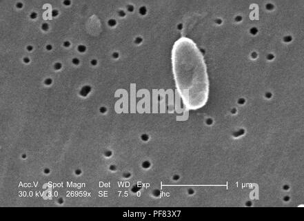 Highly enlarged view of a Ralstonia mannitolilytica bacterium revealed ...