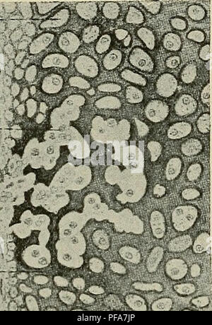 Bone tissue on human embryonic tooth. Photomicrograph Stock Photo - Alamy