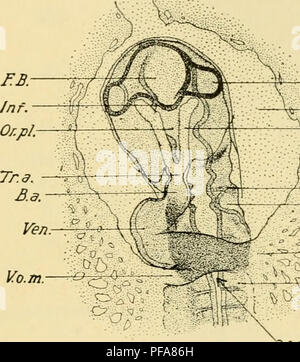 Precocious (early) breast development in a three year old girl. Early ...