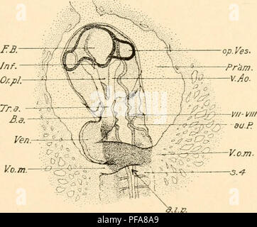 Precocious (early) breast development in a three year old girl. Early ...