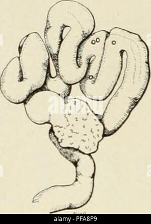 The image shows the early developmental stages of Anchovia mitchilli ...