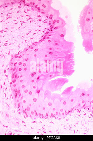 Sample of human bladder tissue seen through microscope, close-up Stock ...