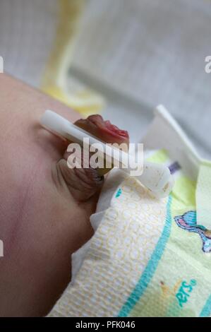 Umbilical cord with clamp of newborn baby, 7 days old Stock Photo - Alamy
