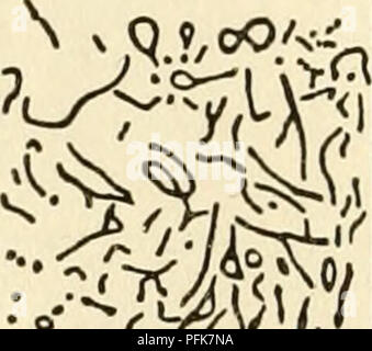 This image illustrates the cytoplasm of plant cells, focusing on the ...