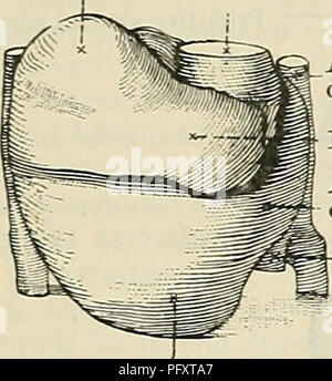 . Cunningham's Text-book of anatomy. Anatomy. Sinus tympani Mastoid air ...
