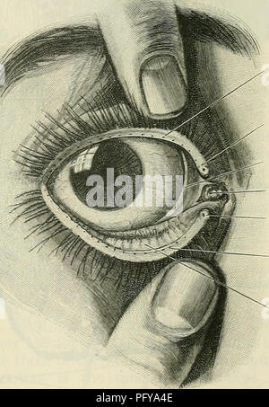 . Cunningham's Text-book of anatomy. Anatomy. Aperture of pupil Long ...