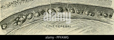 . Cunningham's Text-book of anatomy. Anatomy. DIPLOIC AND MENINGEAL ...