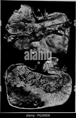 . Fig. 215—Tuberculosis of Testis. Boar. A, Median section ; B ...