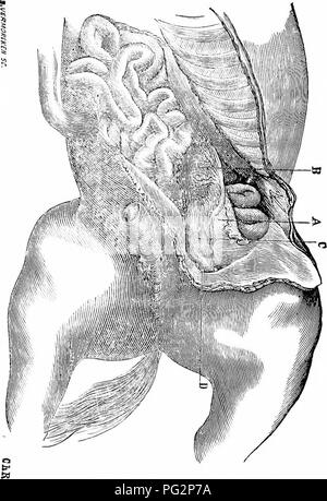 This medical illustration demonstrates the process of animal castration ...