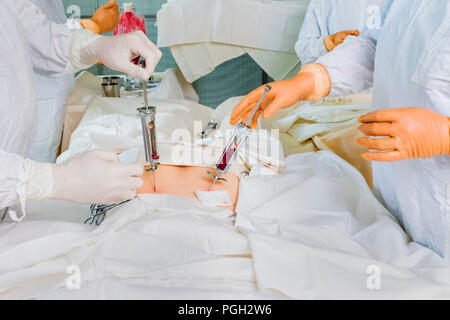 BONE MARROW ASPIRATION Stock Photo - Alamy