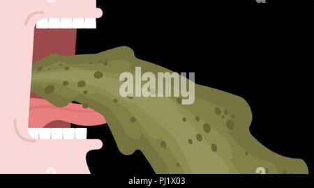 Vomit open mouth. Puke Vector illustration. Retching cartoon. Vomitus ...