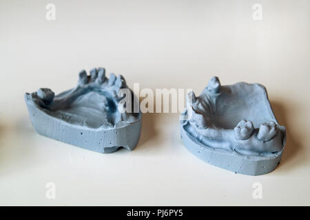 dental prosthesis jaws dentures crowns forceps Stock Photo - Alamy