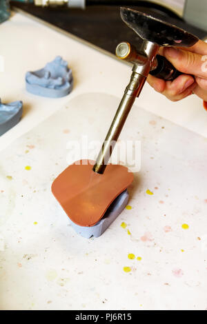 Warming of Shellac base plates. Dentures. Dental prosthesis, dentures ...