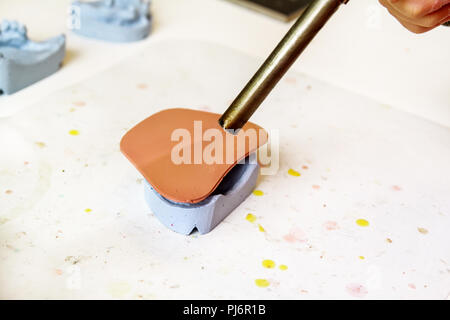 Warming of Shellac base plates. Dentures. Dental prosthesis, dentures ...