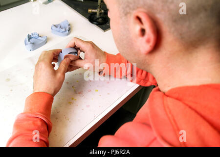 Working with Shellac base plates. Dentures. Dental prosthesis, dentures ...