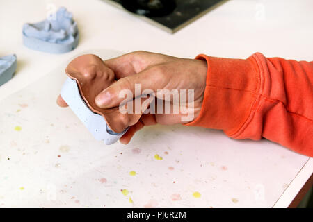 Working with Shellac base plates. Dentures. Dental prosthesis, dentures ...