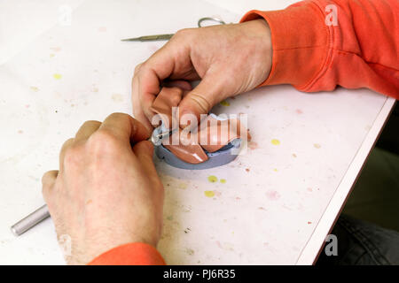 Dental Shellac base plates. Dentures and dentistry. Dental prosthesis ...