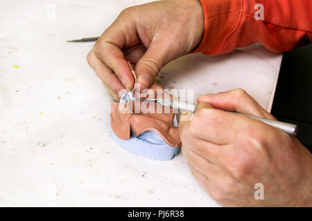 Dental Shellac base plates. Dentures and dentistry. Dental prosthesis ...