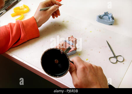 Warming of Shellac base plates. Dentures. Dental prosthesis, dentures ...