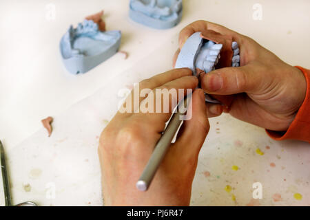 Working with Shellac base plates. Dentures. Dental prosthesis, dentures ...