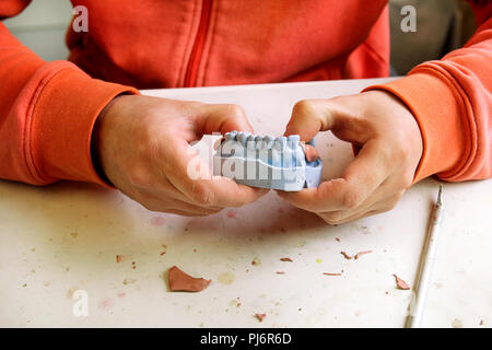 Working with Shellac base plates. Dentures. Dental prosthesis, dentures ...