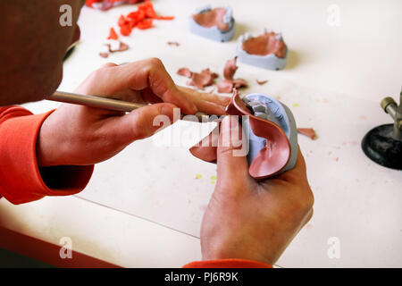 Dental Shellac base plates. Dentures and dentistry. Dental prosthesis ...