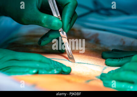 Surgical operation abdominoplasty. Surgical removal of fat tissue from ...