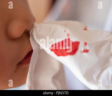 boy with nose bleed Stock Photo - Alamy
