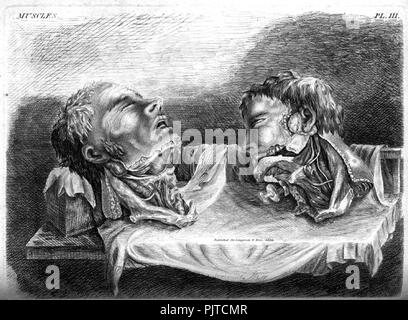 The image 'Bell heads with neck muscles' presents a detailed anatomical ...