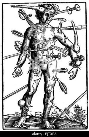 Battlefield wounds 300px Stock Photo - Alamy