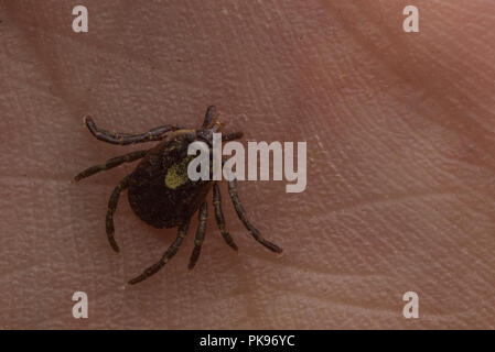 A tick embedded into a human Stock Photo - Alamy