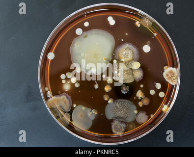 Petri dish with microbes on grey background, top view. Illustration of ...