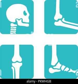 Orthopedic surgery icon set, flat style Stock Vector Image & Art - Alamy