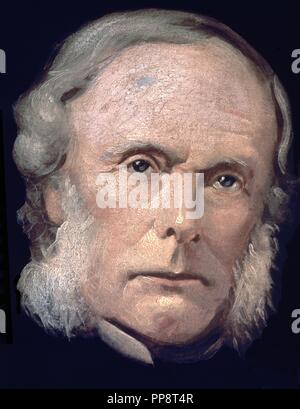 JOSEPH LISTER (1827-1912) British surgeon (centre) watches assistant ...