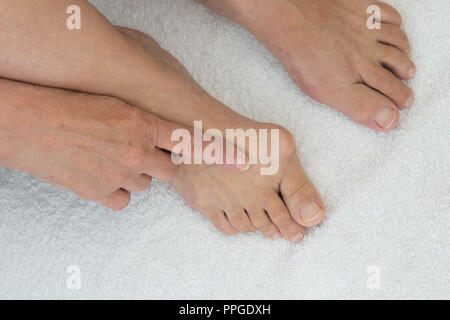 Toe operation on the big toe Stock Photo - Alamy