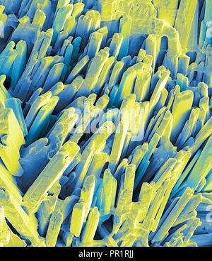 Cholesterol crystals at SEM (Scanning Electron Microscope Stock Photo ...