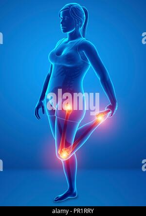 Woman with leg pain, computer illustration Stock Photo - Alamy