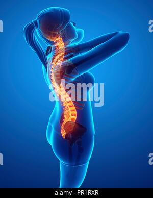 Woman with back pain, computer illustration Stock Photo - Alamy