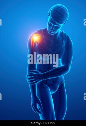 Man with shoulder pain, computer illustration Stock Photo - Alamy