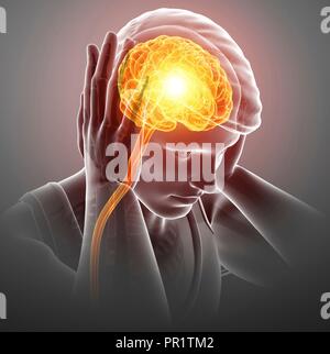 Headache, computer illustration Stock Photo - Alamy