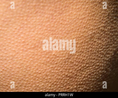 Goosebumps Skin Background Stock Photo - Alamy