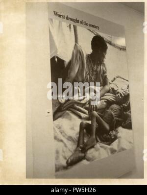 Snapshot of an emaciated patient, laying in a hospital bed Stock Photo ...