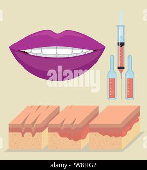 Skin subcutaneous Injection diagram illustration Stock Vector Image ...