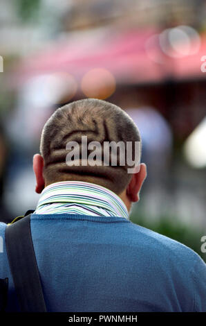 Male head with hair loss symptoms back side Stock Photo - Alamy