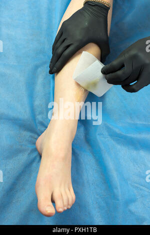 Process depilation female legs and hands in a beauty salon Stock Photo ...
