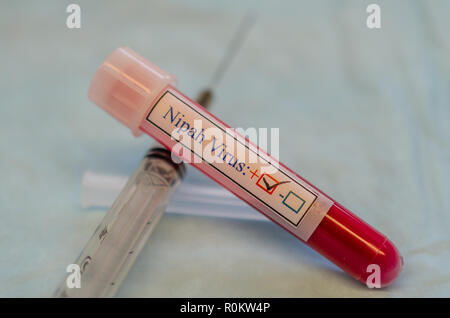 Nipah Virus - Test with blood sample. Top view isolated on black ...
