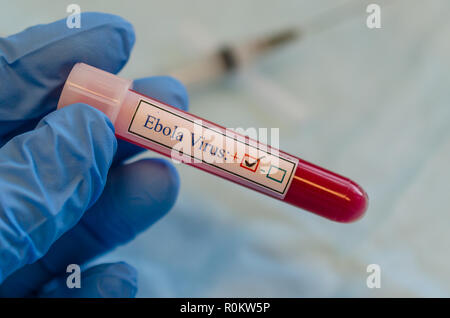 Ebola Virus Blood Sample in Test Tube, Medical Laboratory Illustration ...