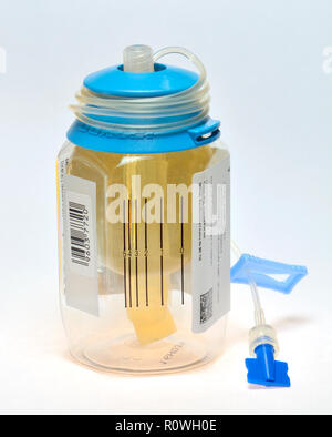 Intravenous antibiotics bottle (Baxter Intermate) and delivery system ...
