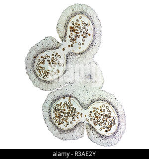 Light photomicrograph of Lily anther cross section seen through ...