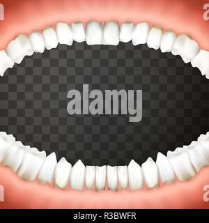 Healthy jaw, gums, palate and teeth of a six month old female Somali ...